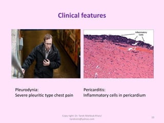 Enteroviruses and polio | PDF