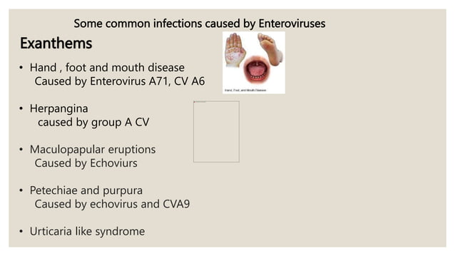 enterovirus meningitis.pptx