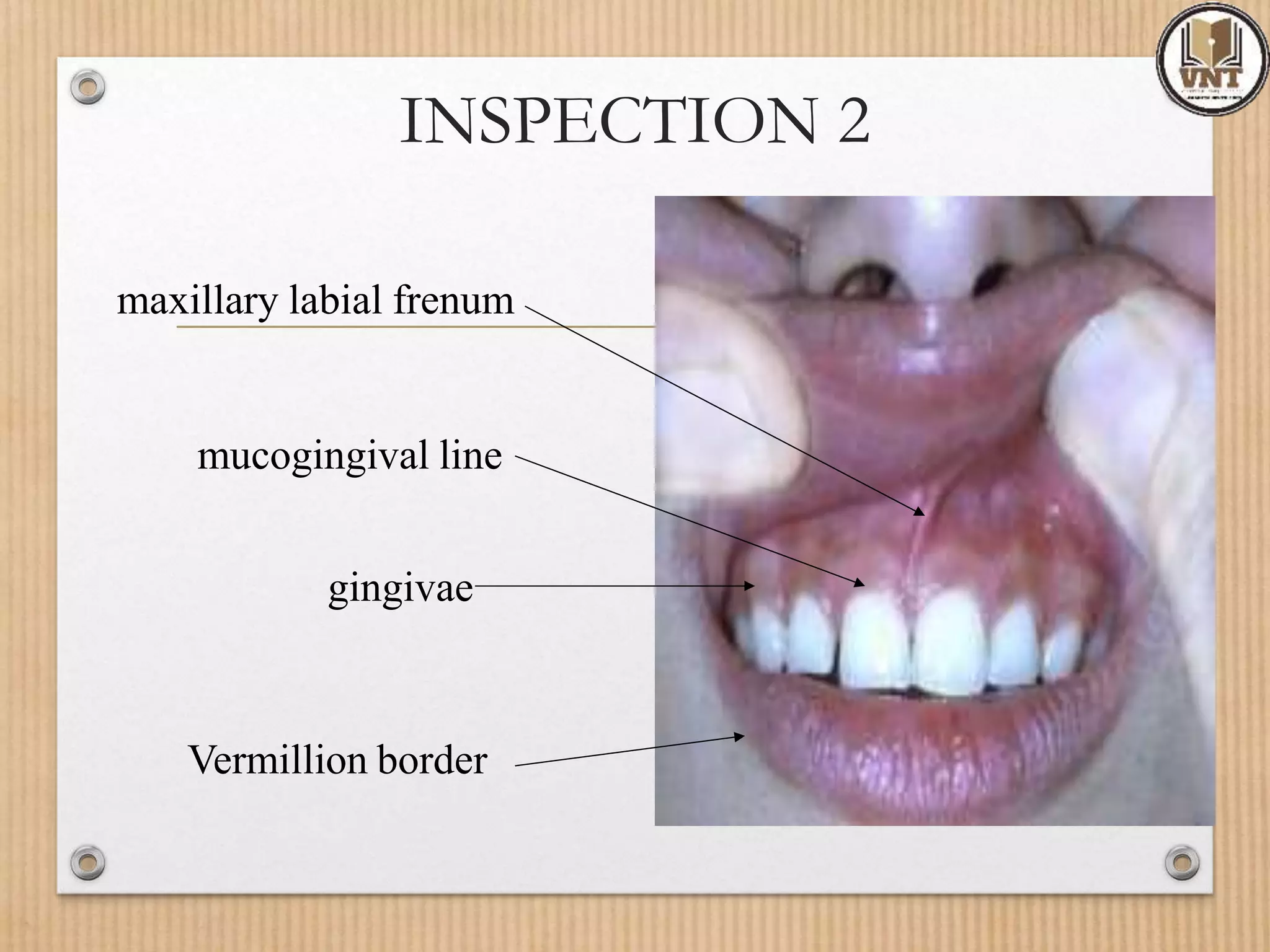ENT Examination | PPTX