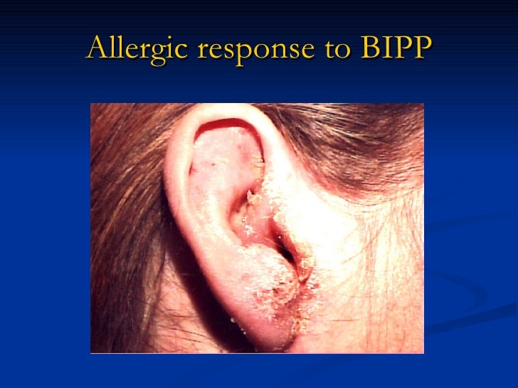 Ent gp emergencies (edited)