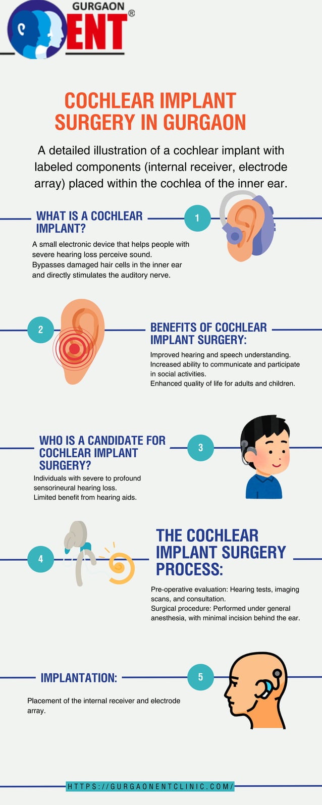 Cochlear Implant Surgery in Gurgaon (ENT INFOGRAPHY) | PDF