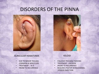 Ent in General Practice | PPT