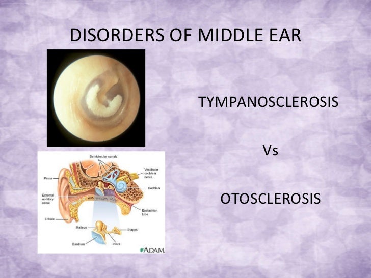 Ent in General Practice