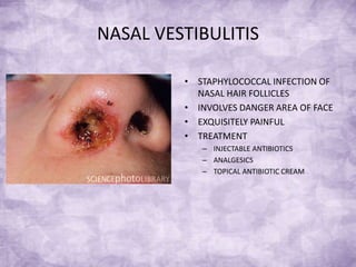 ent in gp.ppt