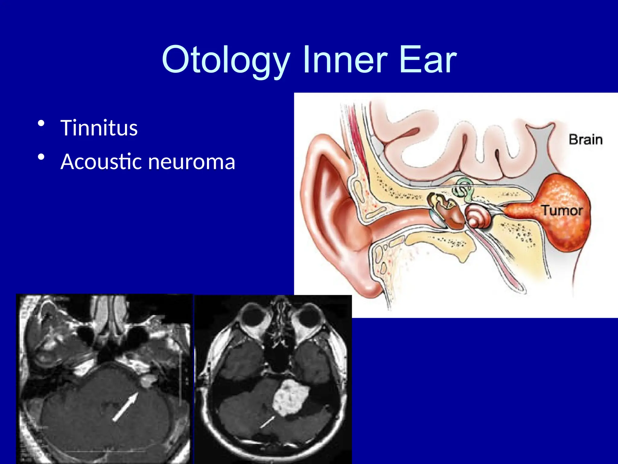 Ear Nose and throat Introduction with brief explanation | PPT
