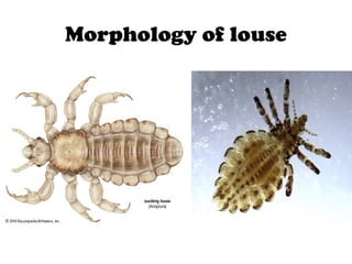 Entomology Louse, Bedbugs & Sand fly | PPT
