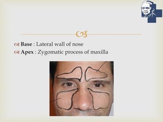 Anatomy of paranasal air sinuses | PPTX