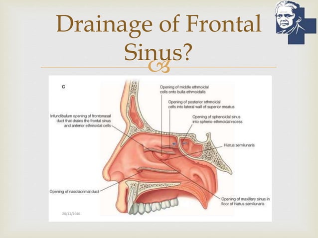 Anatomy of paranasal air sinuses