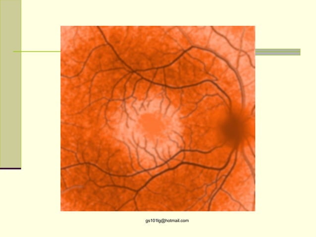 Entopic phenomenon | PPT