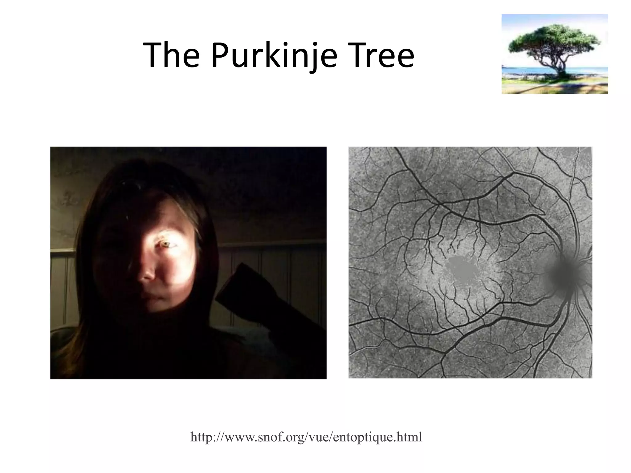 Entoptic phenomena | PDF