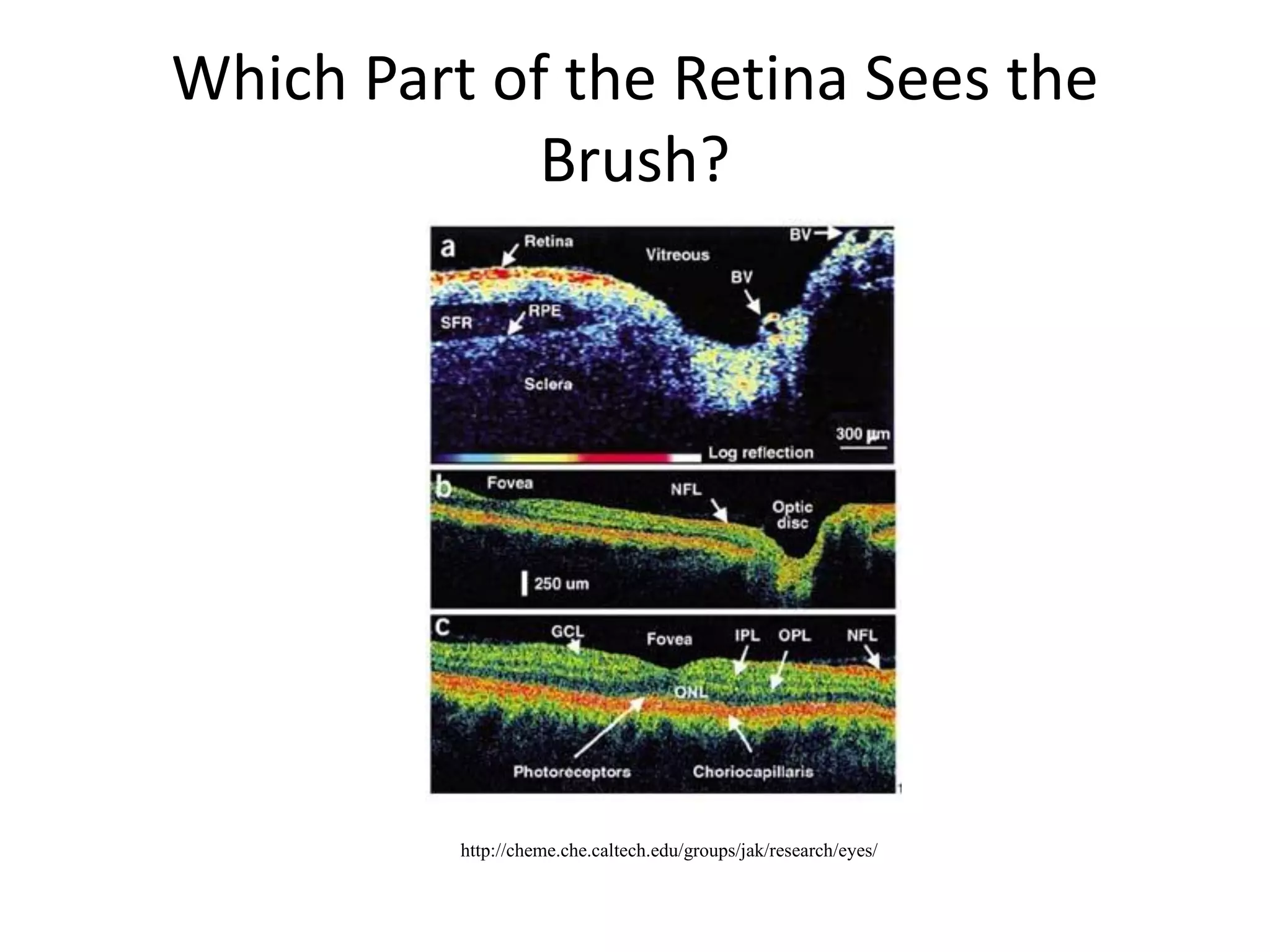 Entoptic phenomena | PDF