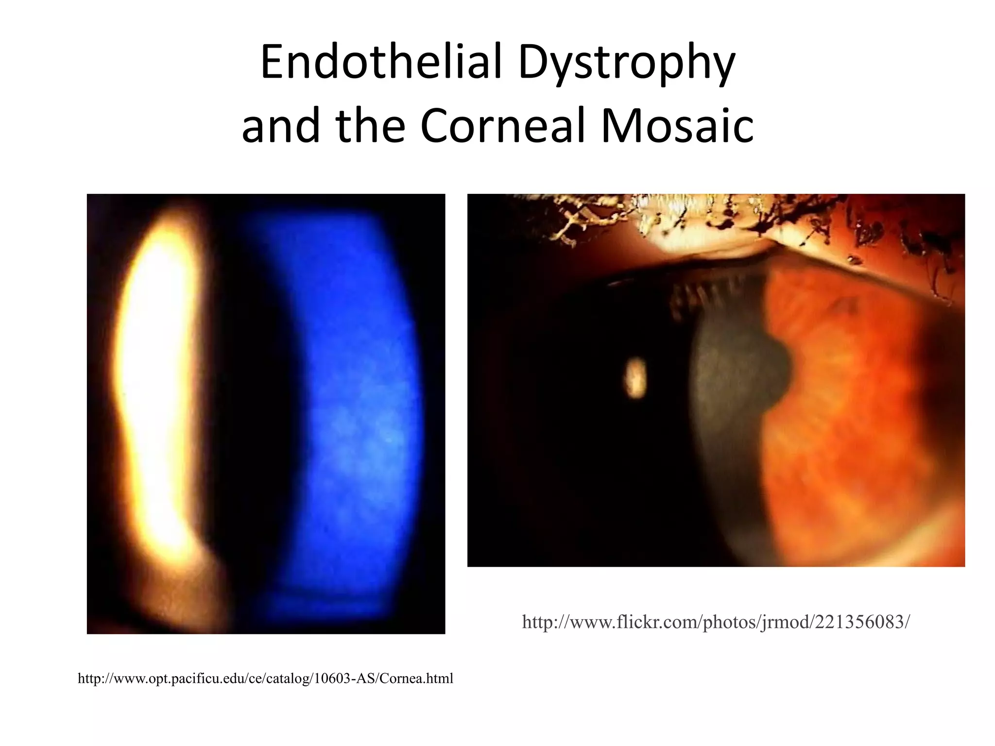 Entoptic phenomena | PDF