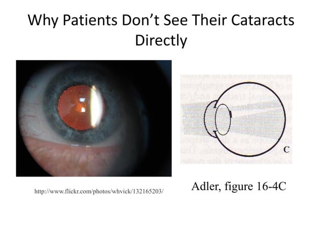 Entoptic phenomena | PDF | Eye and Vision Conditions | Diseases and ...