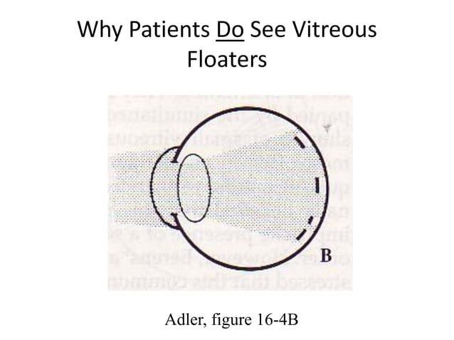 Entoptic phenomena | PDF | Eye and Vision Conditions | Diseases and ...