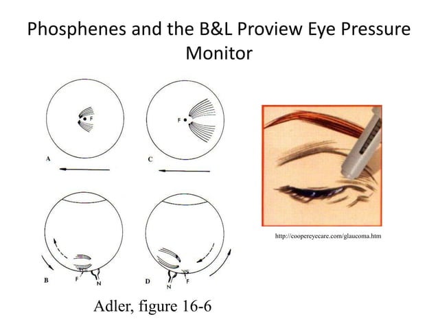 Entoptic phenomena | PDF | Eye and Vision Conditions | Diseases and ...
