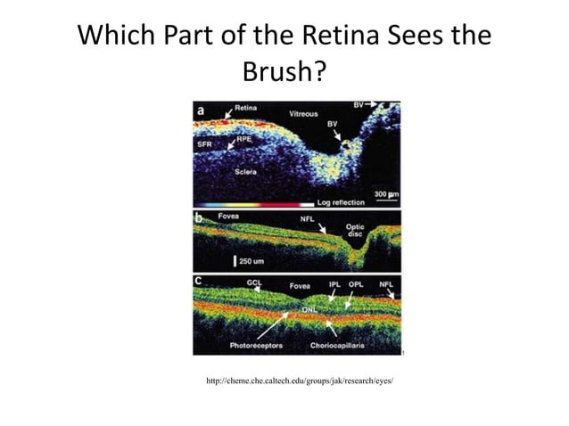 Entoptic phenomena | PDF | Eye and Vision Conditions | Diseases and ...