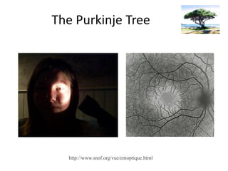 Entoptic phenomena | PPT