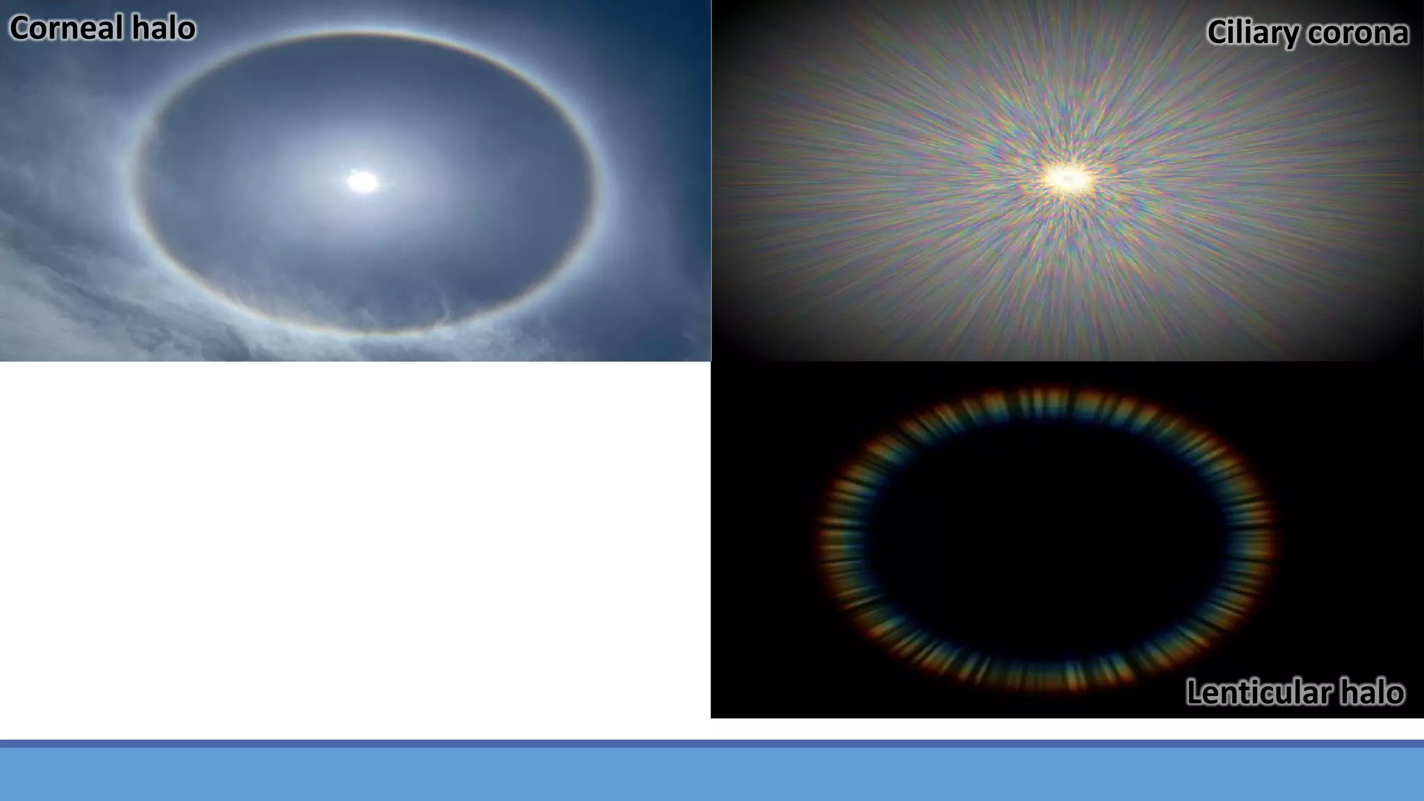 Entoptic phenomena | PPT