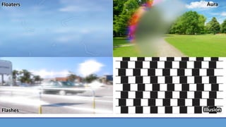 Entoptic phenomena | PDF