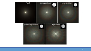 Entoptic phenomena | PDF