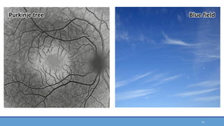 Entoptic phenomena | PDF