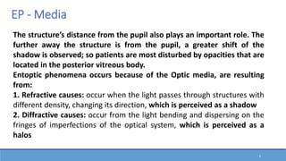 Entoptic phenomena | PDF