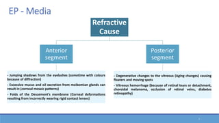 Entoptic phenomena | PDF