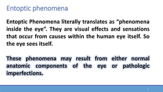 Entoptic phenomena | PPT