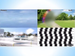 Entoptic Phenomena.pptx
