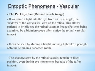 Entoptic Phenomena.pptx