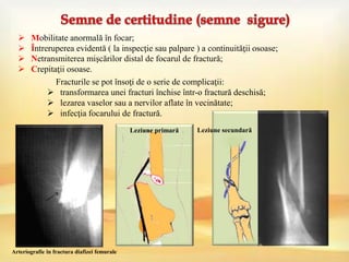 Entorse,luxatii, fracturi | PPTX