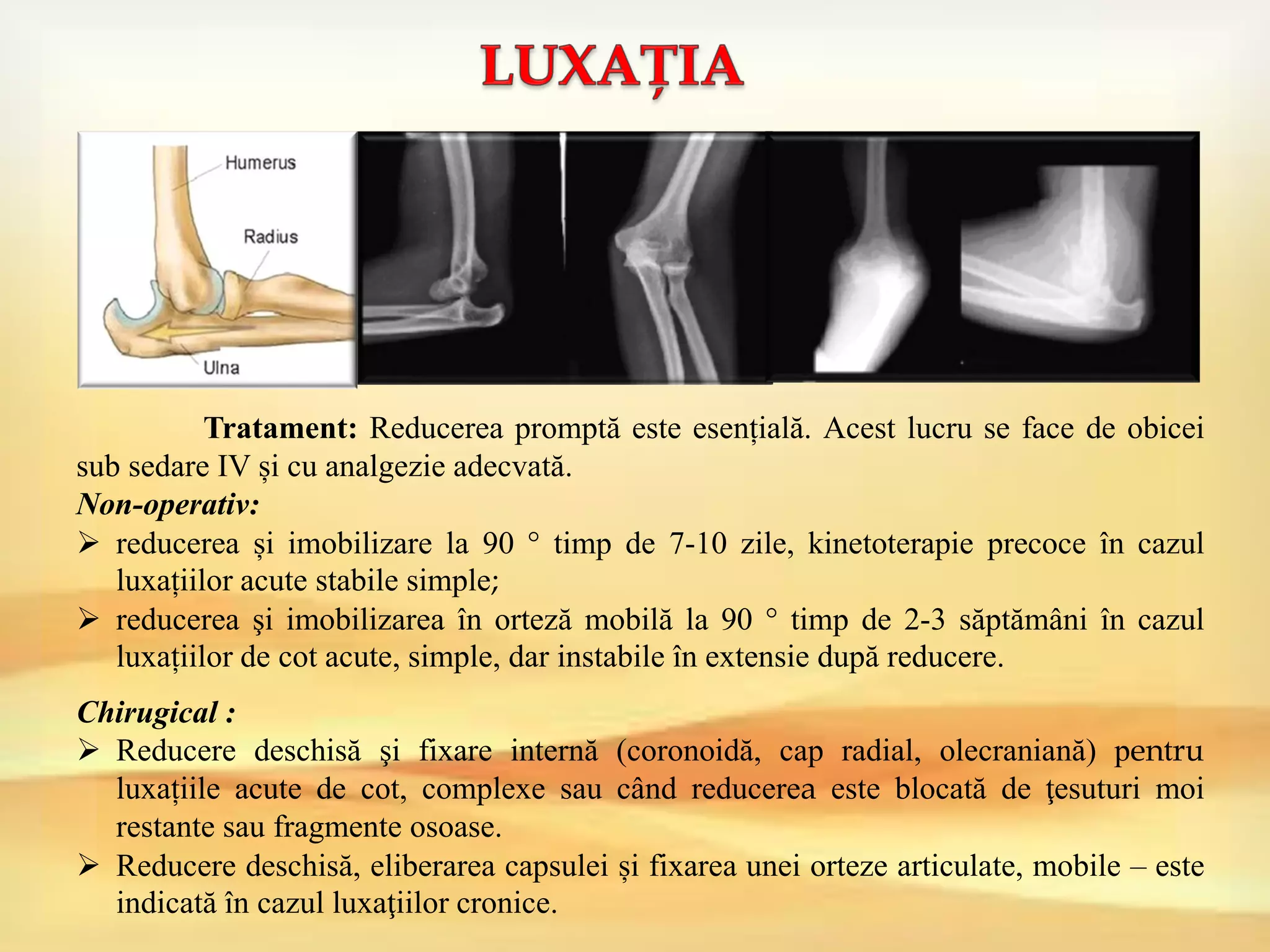 Entorse, luxatii, fracturi | PDF
