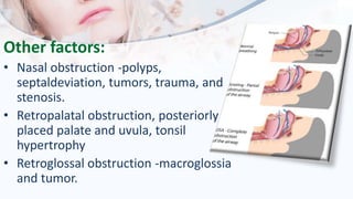 obstructive sleep apnoea | PPT