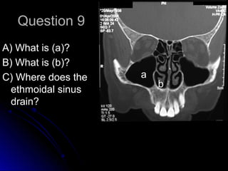 Ent osce for medical students and doctors.pdf