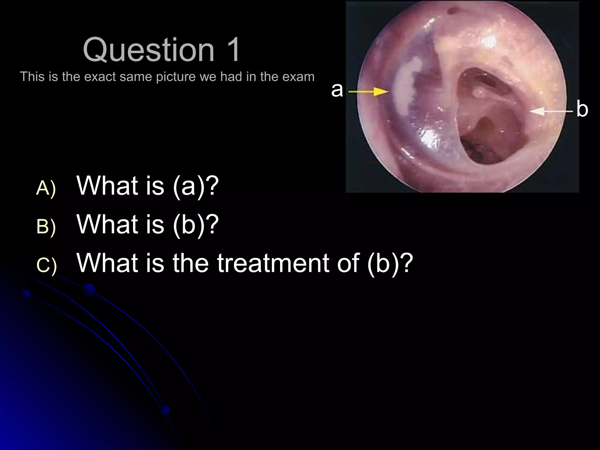 Ent osce | PPT | Ear, Nose and Throat Conditions | Diseases and Conditions