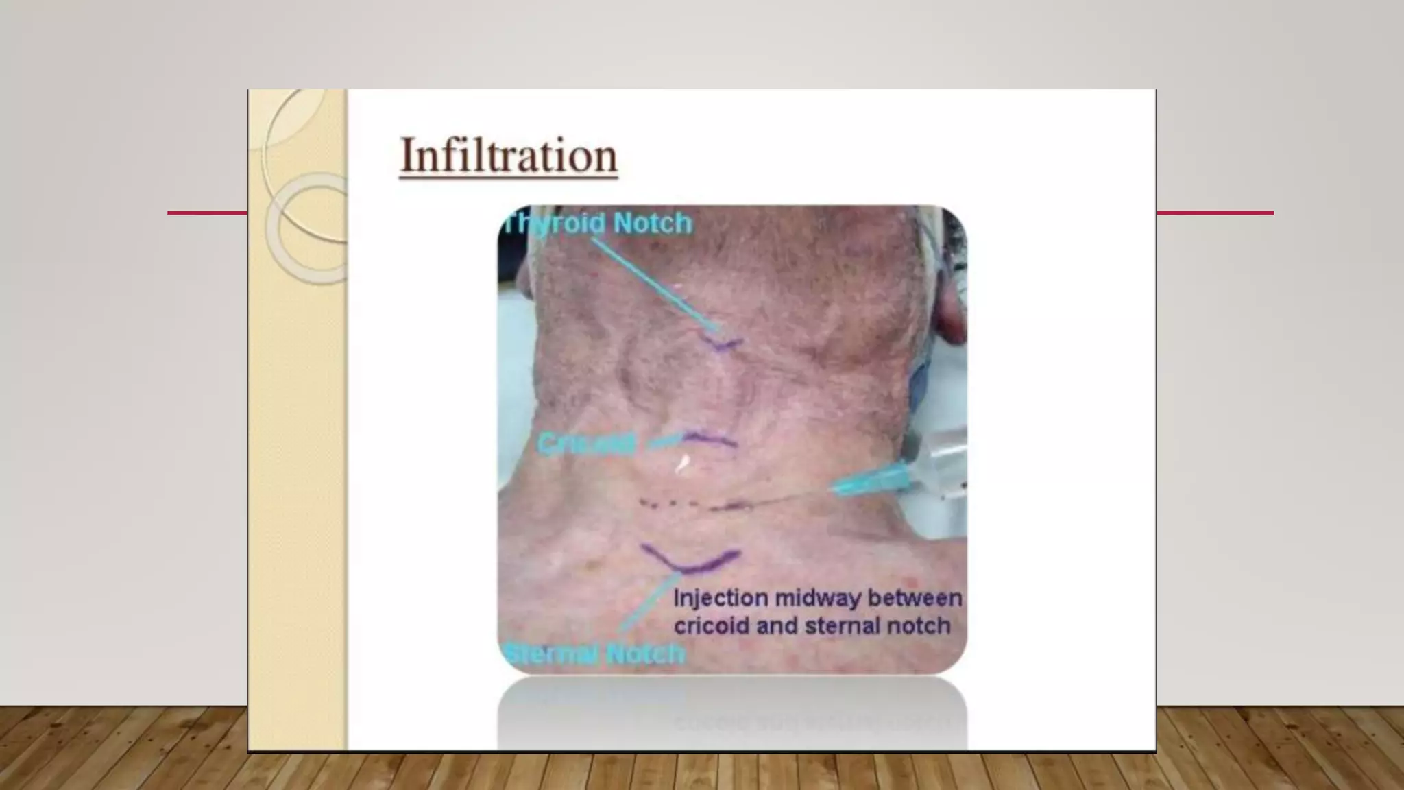 Ent osce examination and instruments | PPTX