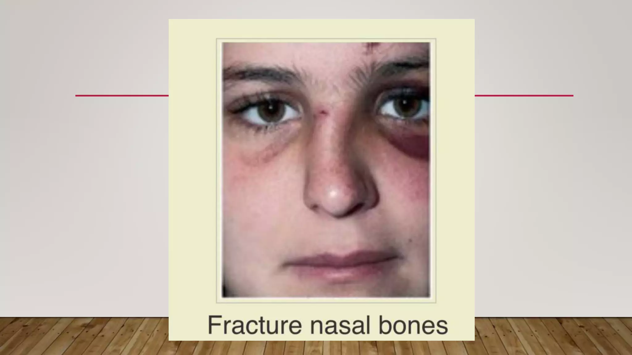 Ent osce examination and instruments | PPTX