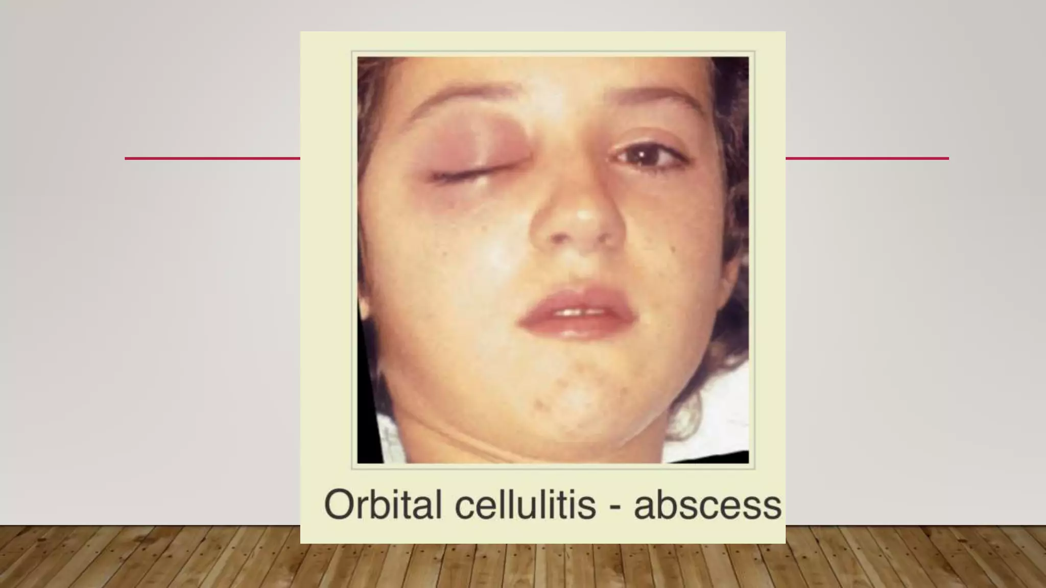 Ent osce examination and instruments | PPTX