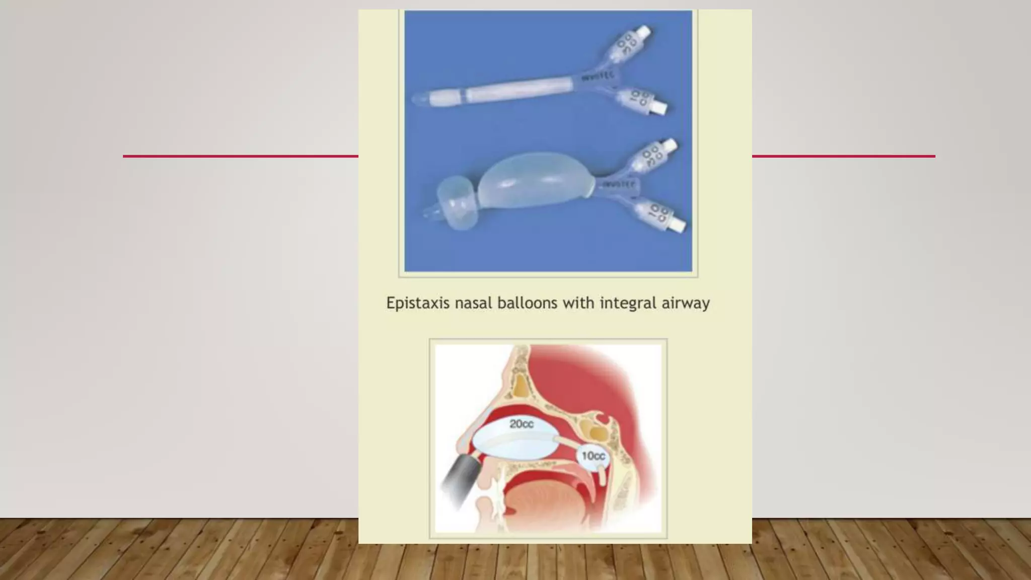 Ent osce examination and instruments | PPTX