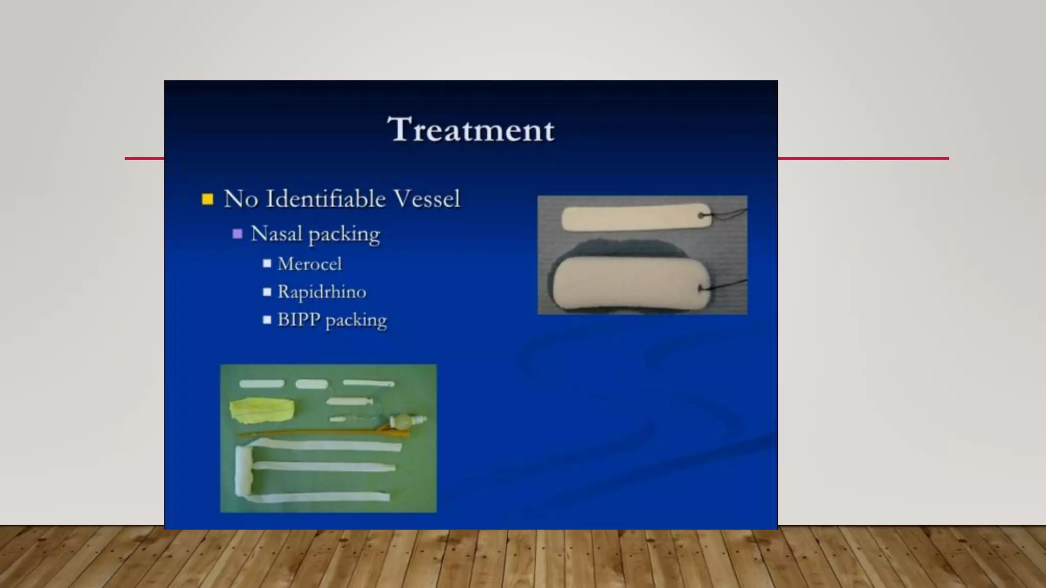 Ent osce examination and instruments | PPTX