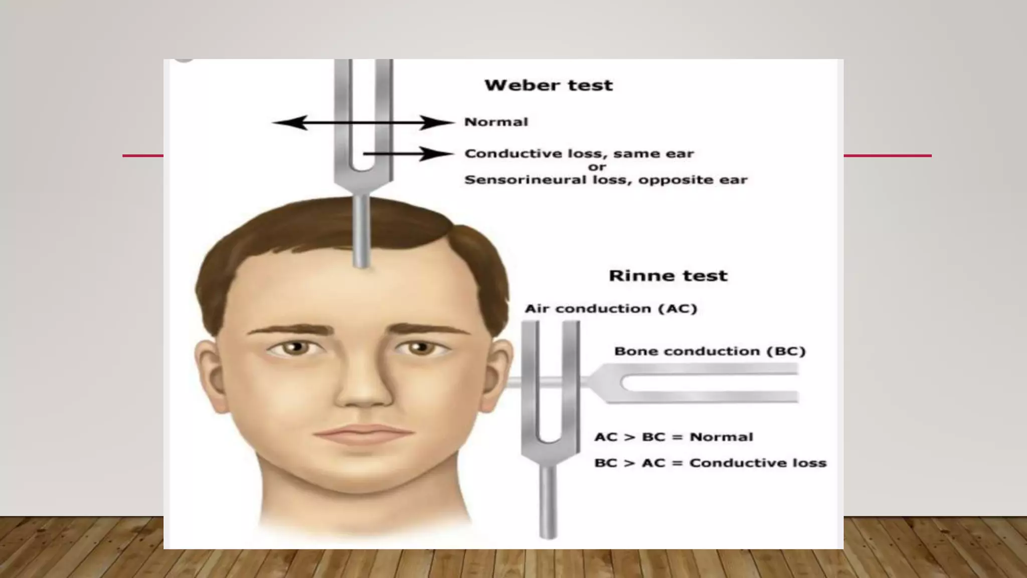 Ent osce examination and instruments | PPTX