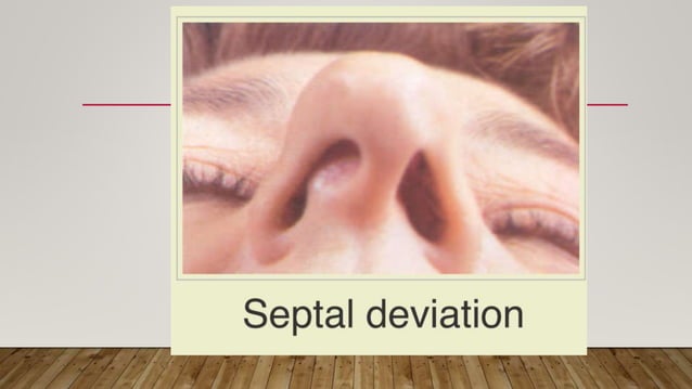 Ent osce examination and instruments | PPTX