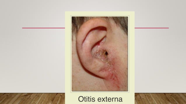 Ent osce examination and instruments | PPTX