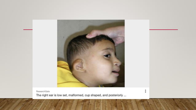 Ent osce examination and instruments | PPTX