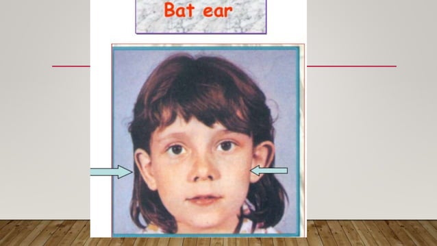 Ent osce examination and instruments | PPTX