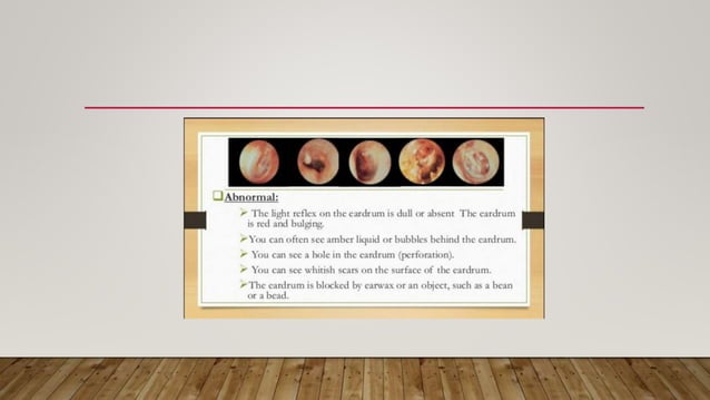 Ent osce examination and instruments | PPTX