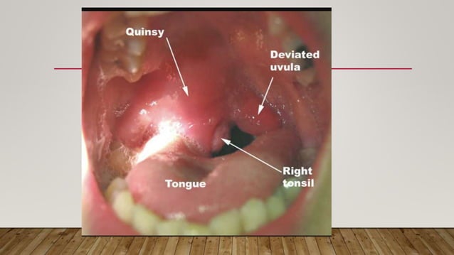Ent osce examination and instruments | PPTX