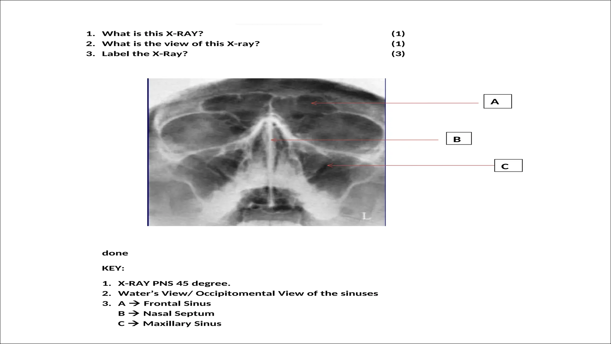 ENT ospe 1 .pdf .....good and easy for medical | PDF