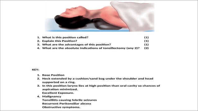 ENT ospe 1 .pdf .....good and easy for medical | PDF | Ear, Nose and Throat Conditions ...