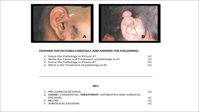 ENT ospe 1 .pdf .....good and easy for medical | PDF | Ear, Nose and ...